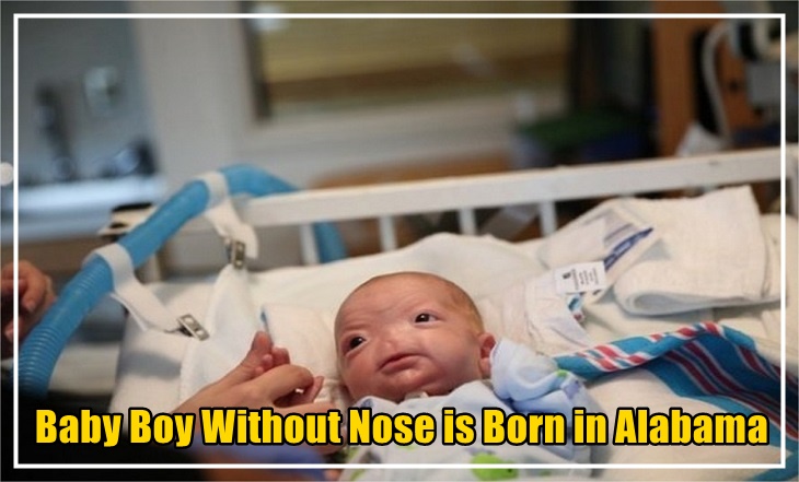 Cute Baby Boy Timothy Eli Thompson Born Without Nose in Alabama