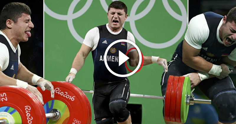 Watch: Horrifying Moment For Athelete, Hyper-Extended Elbow Injury In ...