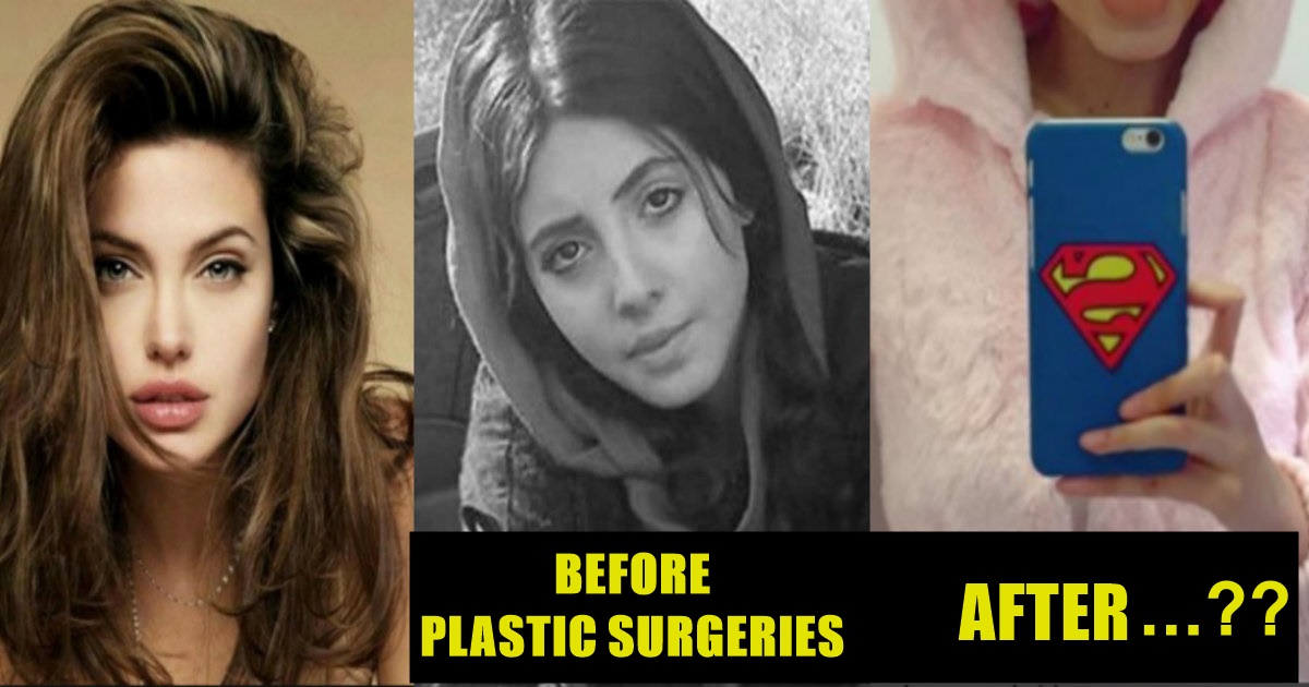 19-Year-Old Girl Got 50 Surgeries To Look Like Angelina Jolie, Now ...