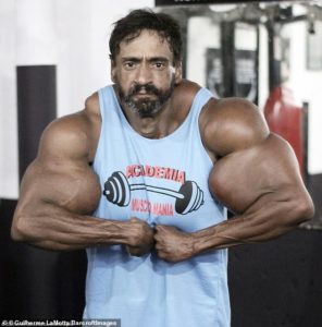 Brazilian Bodybuilder Who Injects Oil Into Biceps Shares Before And ...