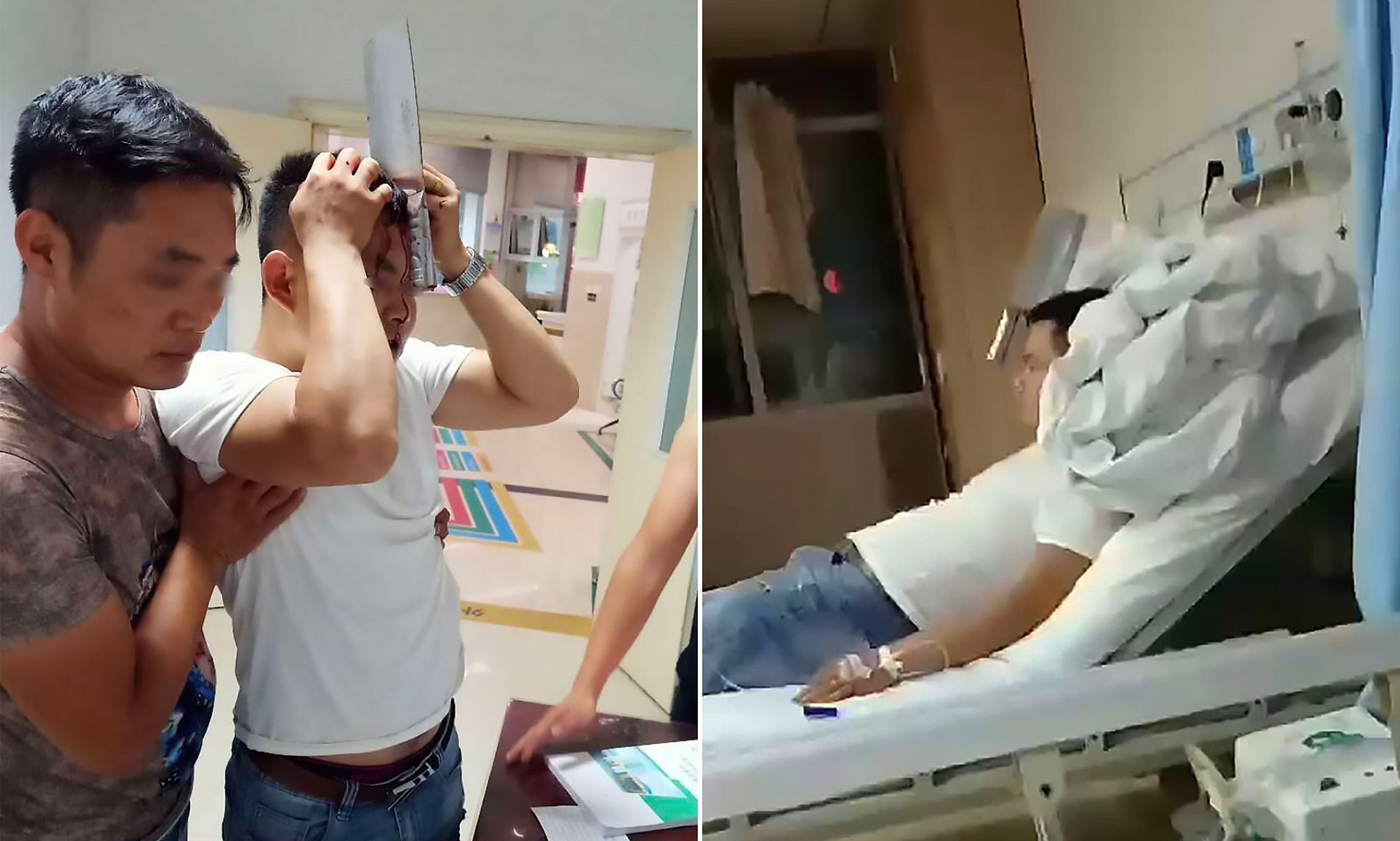 Chinese Man Walks Into Hospital With Meat Cleaver Stuck In Forehead
