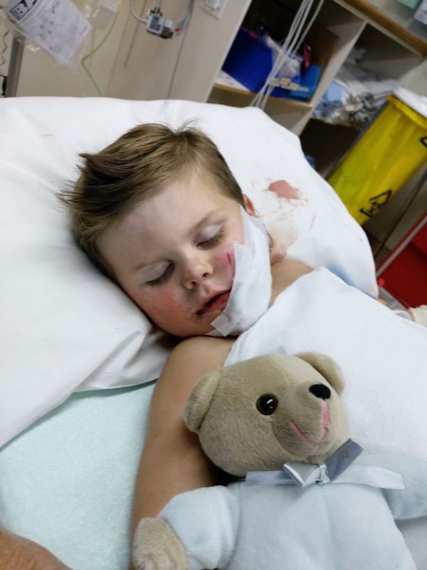 Lucky To Be Alive: 2-Year-Old Boy Almost Lost His Life After Violent ...